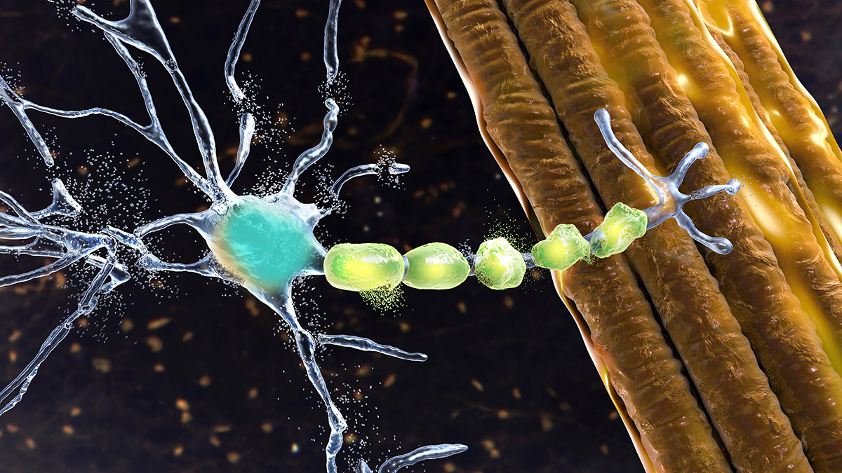 Neuroinflammatory Diseases Research | PPD