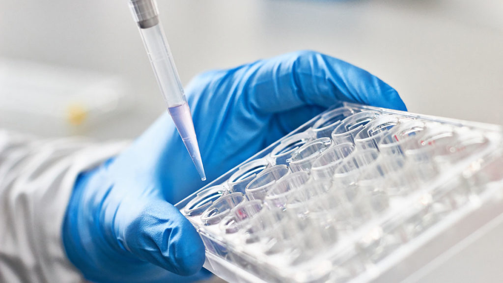 The Importance of Bioanalytical Assays in Biosimilar Development | PPD