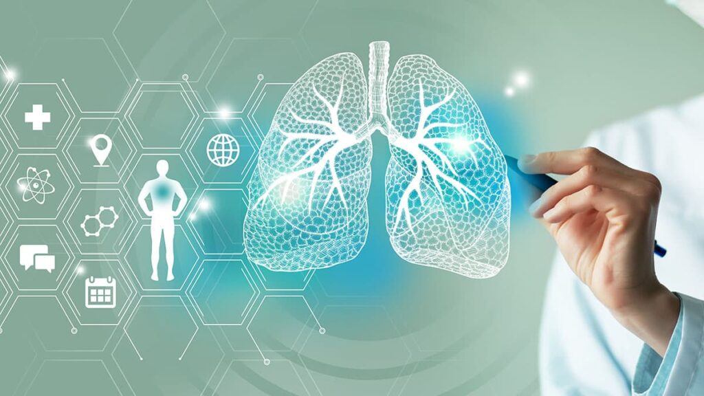 Shifting Paradigms in PAH Clinical Trials: 7 Key Takeaways | PPD